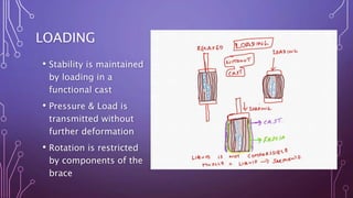 Dr.S.Senthil Sailesh-functional cast bracing,PTBcast,sarmiento ...