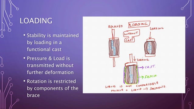 Dr.S.Senthil Sailesh-functional cast bracing,PTBcast,sarmiento ...