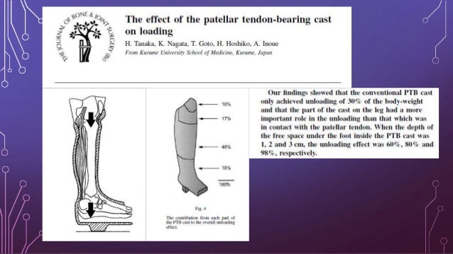 Dr.S.Senthil Sailesh-functional cast bracing,PTBcast,sarmiento princi…