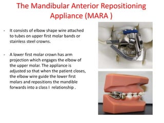 Mara Appliance