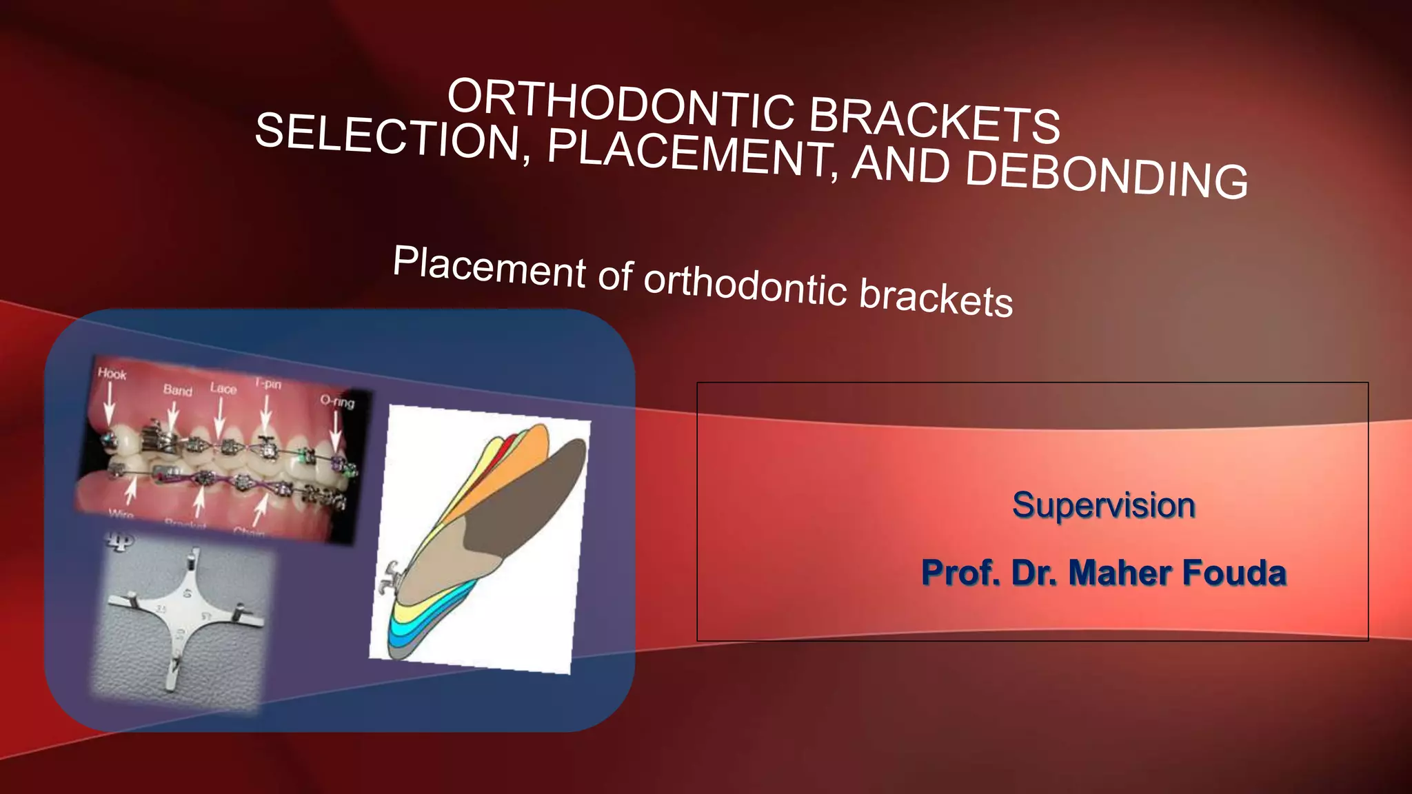 Bracket positioning | PPTX | Dental Health | Diseases and Conditions