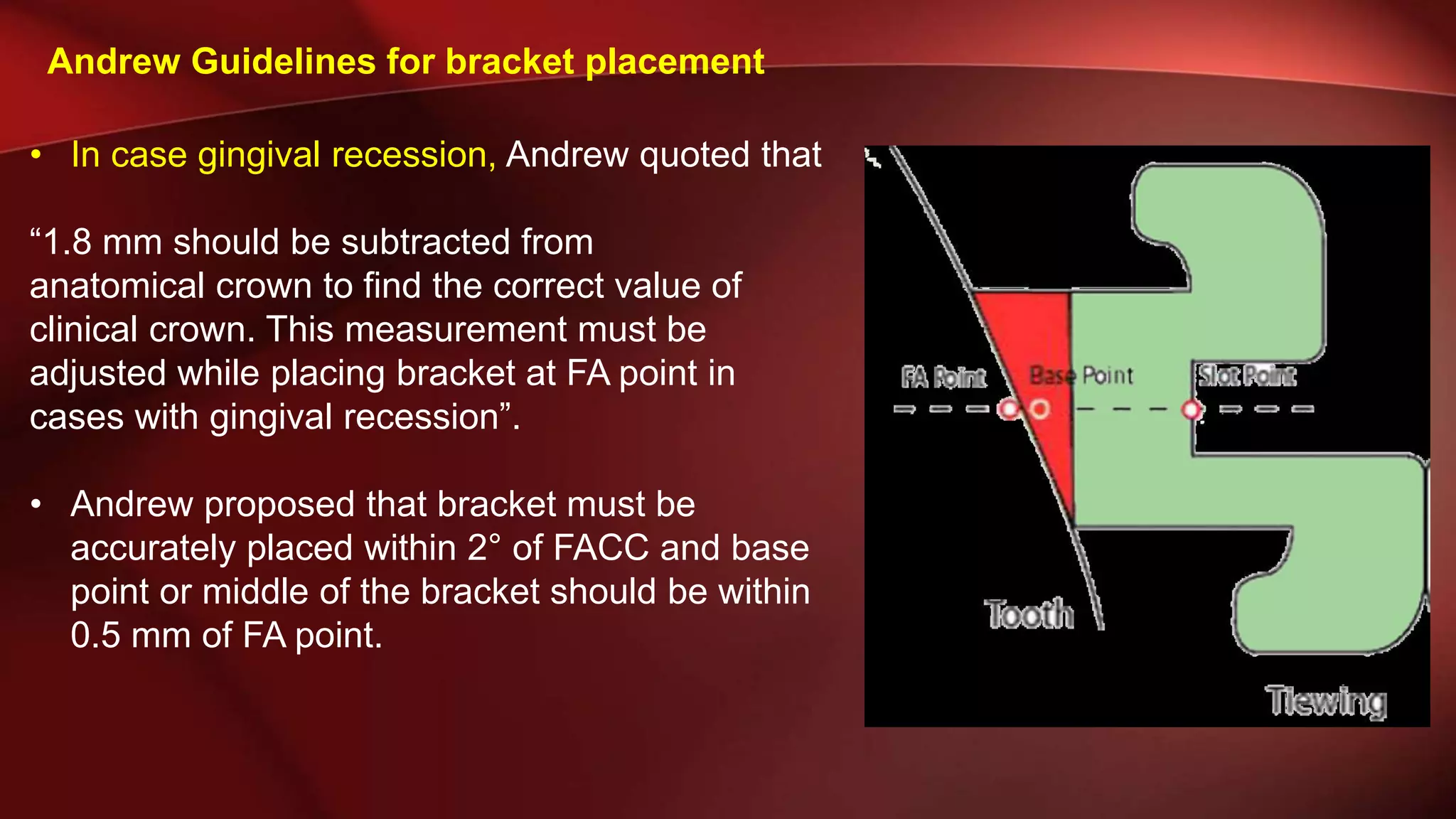 Bracket positioning | PPTX