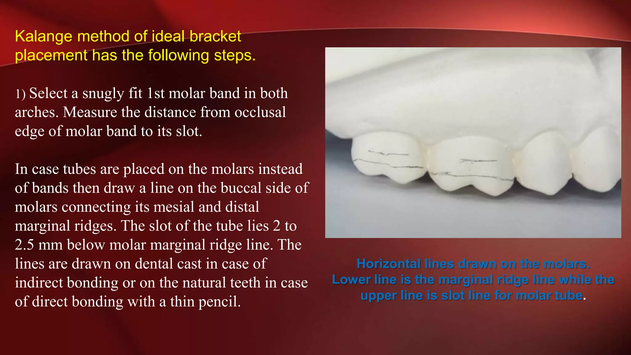 Bracket positioning | PPTX