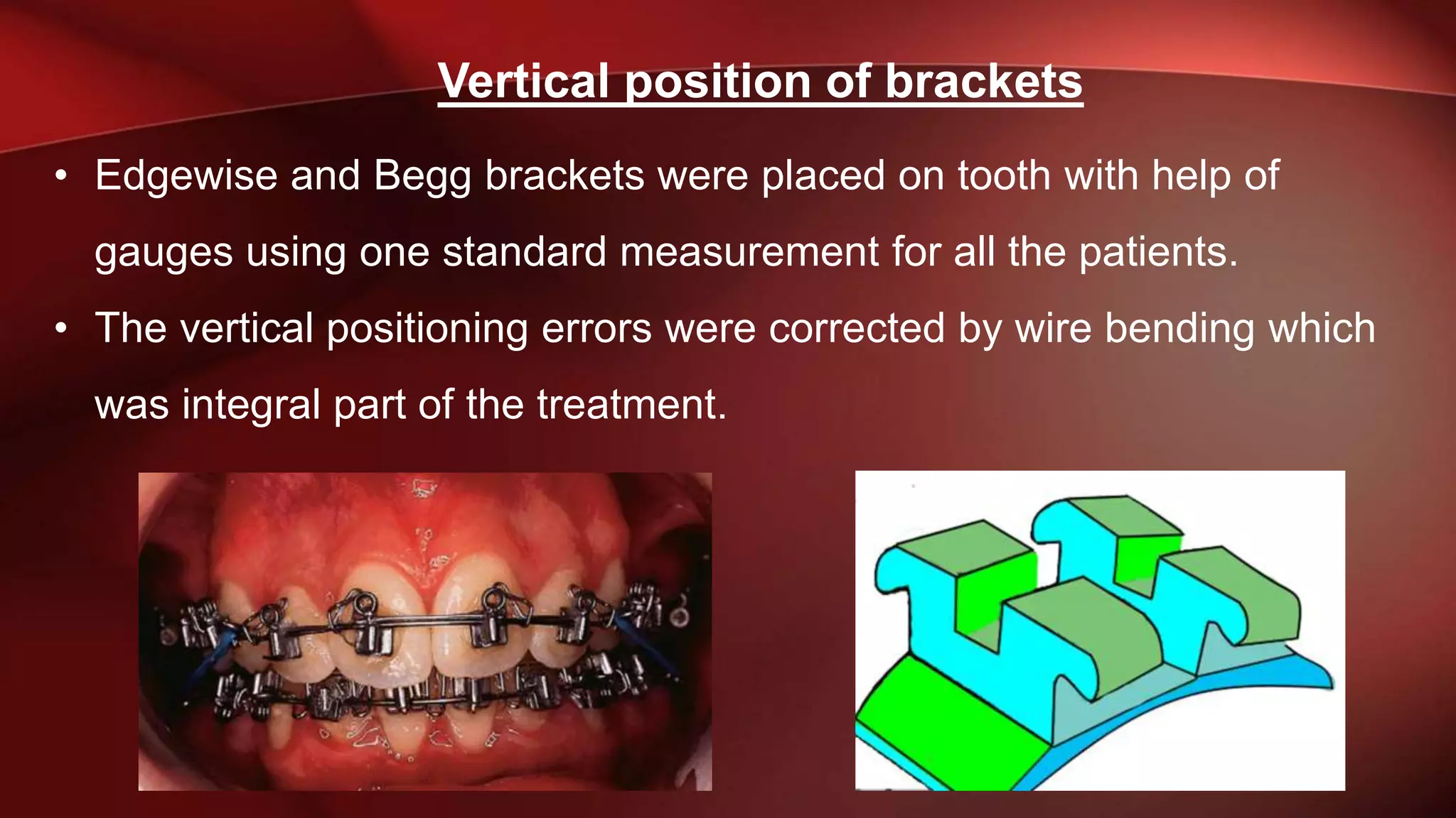 Bracket positioning | PPTX | Dental Health | Diseases and Conditions