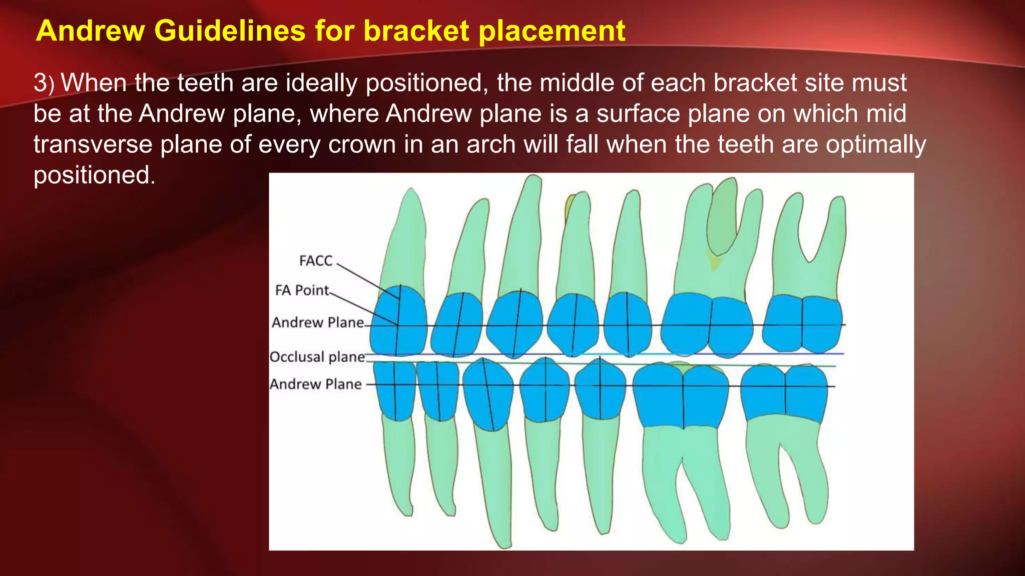 Bracket positioning | PPTX | Dental Health | Diseases and Conditions