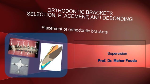 Bracket positioning | PPTX | Dental Health | Diseases and Conditions