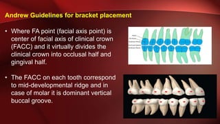 Bracket positioning | PPTX