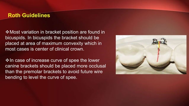 Bracket positioning | PPTX | Dental Health | Diseases and Conditions