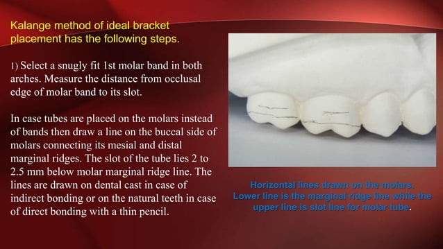 Bracket positioning | PPTX | Dental Health | Diseases and Conditions