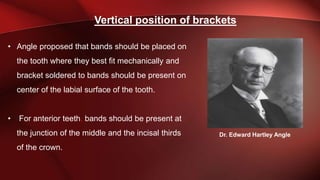 Bracket positioning | PPTX