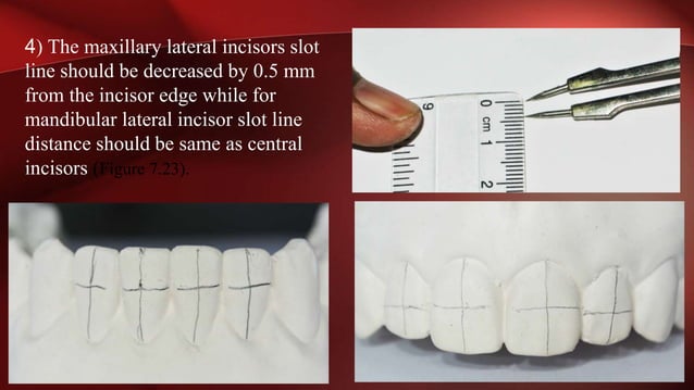 Bracket positioning | PPTX | Dental Health | Diseases and Conditions