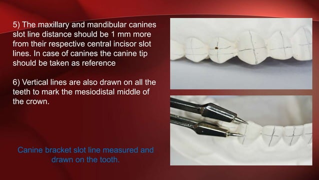 Bracket positioning | PPTX | Dental Health | Diseases and Conditions