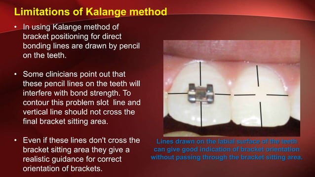 Bracket positioning | PPTX | Dental Health | Diseases and Conditions
