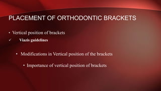 Bracket positioning | PPTX