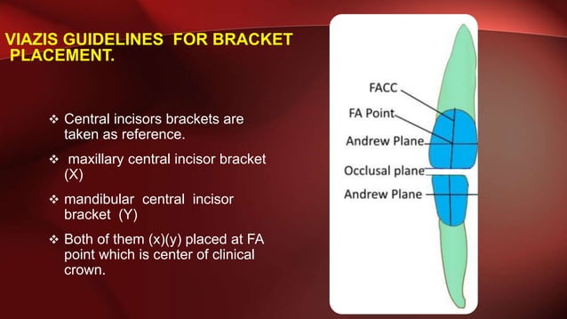 Bracket positioning | PPTX | Dental Health | Diseases and Conditions