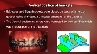 Bracket positioning | PPTX