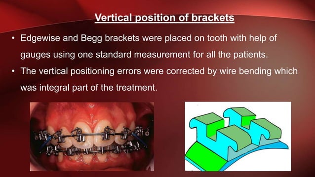 Bracket positioning | PPTX | Dental Health | Diseases and Conditions