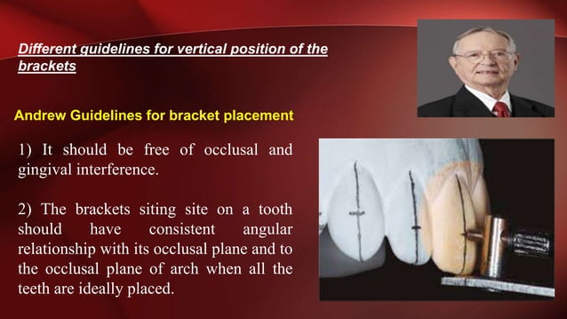 Bracket positioning | PPTX | Dental Health | Diseases and Conditions