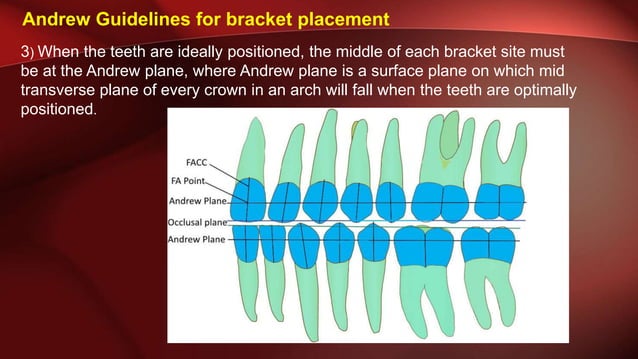 Bracket positioning | PPTX | Dental Health | Diseases and Conditions