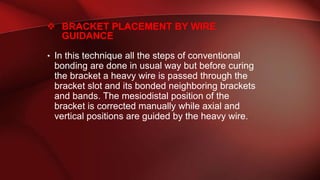 Bracket positioning | PPTX