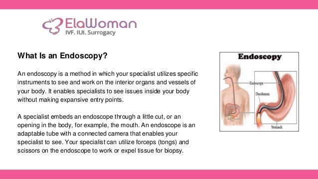 Endoscopy Meaning