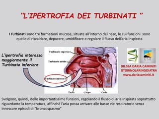 Dr.ssa Daria Caminiti - Ipertrofia dei turbinati | PPTX