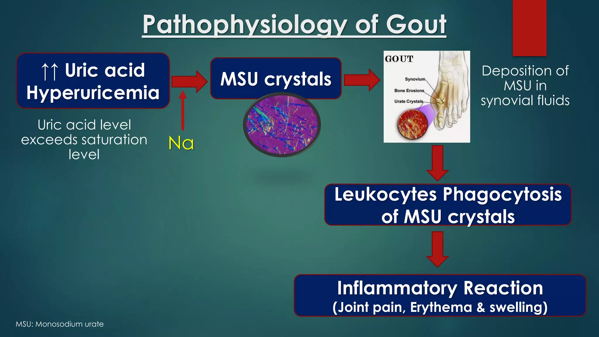Gout and Hyperuricemia | PDF