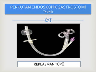 Perkutan Endoskopik Gastrostomi ve Hemsirelik Uygulamaları | PPTX