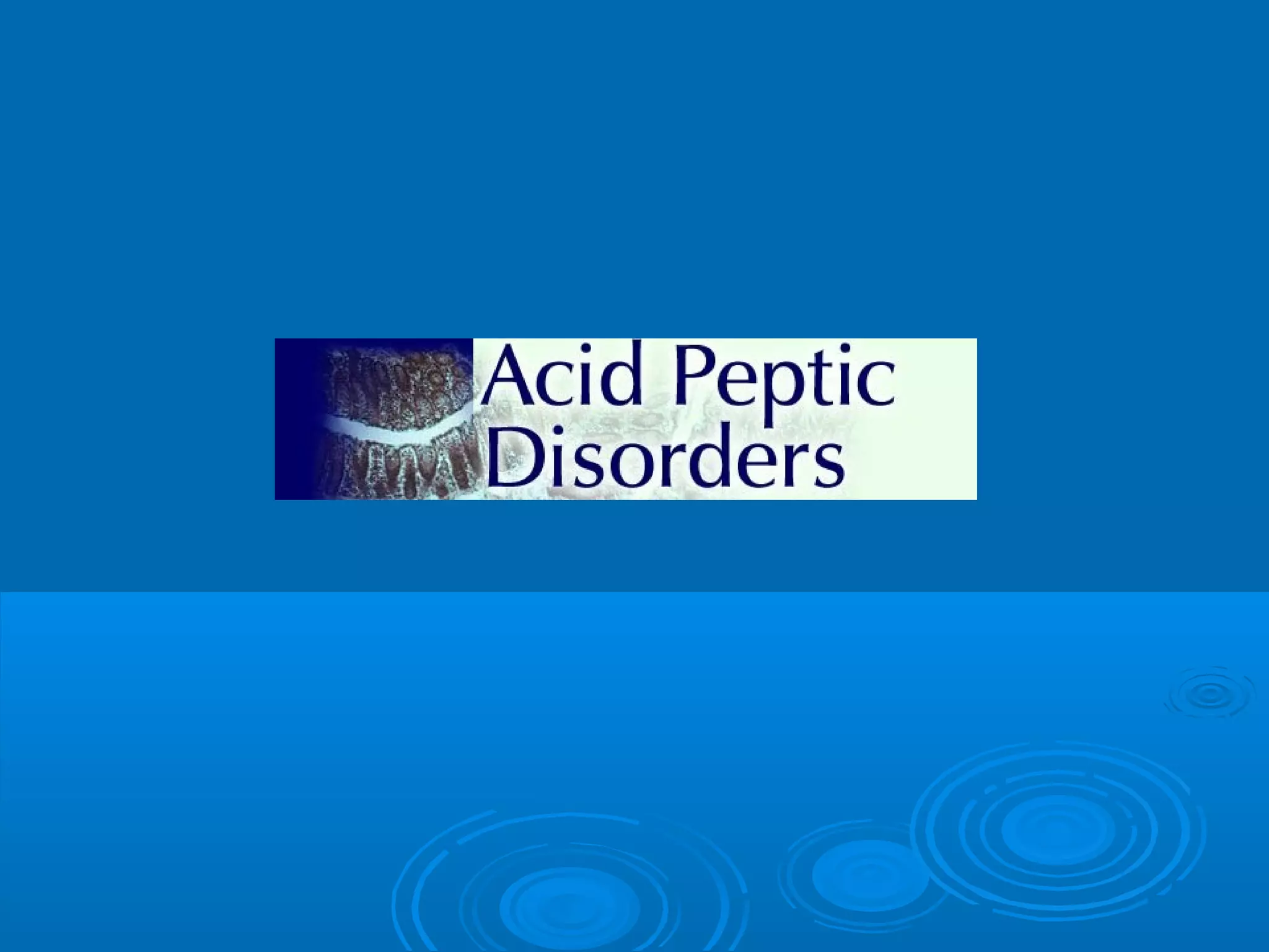 acid peptic disease | PPT