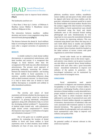 Determination Of Dental Midline in Camouflage Orthodontic Treatment Of ...