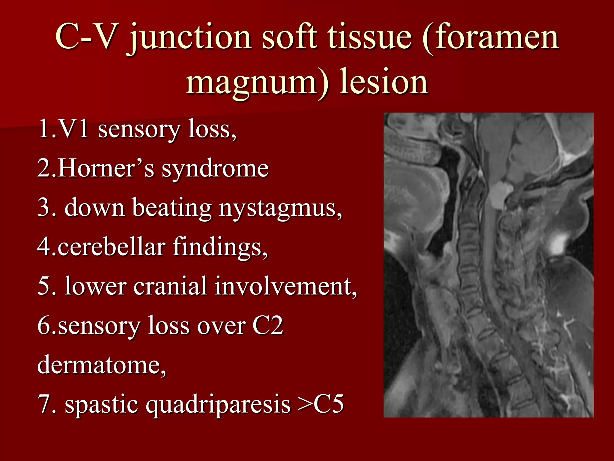 localization spinal cord | PPTX