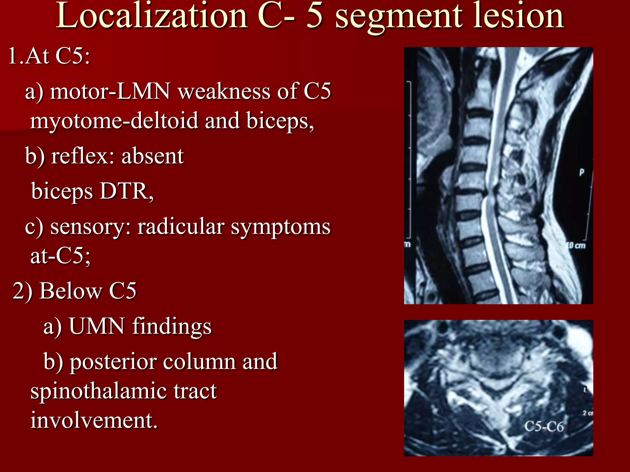 localization spinal cord | PPTX