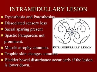 localization spinal cord | PPTX