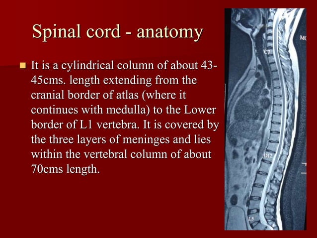localization spinal cord | PPTX | Death, Injury, or Military Conflict ...