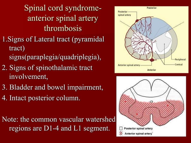 localization spinal cord | PPTX | Death, Injury, or Military Conflict ...