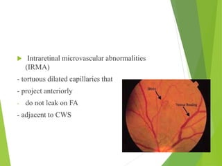 Diabetic retinopathy | PPT