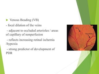 Diabetic retinopathy | PPTX