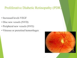 Diabetic retinopathy | PPT