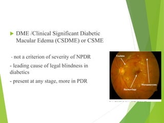Diabetic retinopathy | PPT