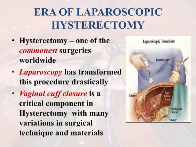 Vaginal Vault suturing in TLH | PPTX | Reproductive Health | Diseases ...