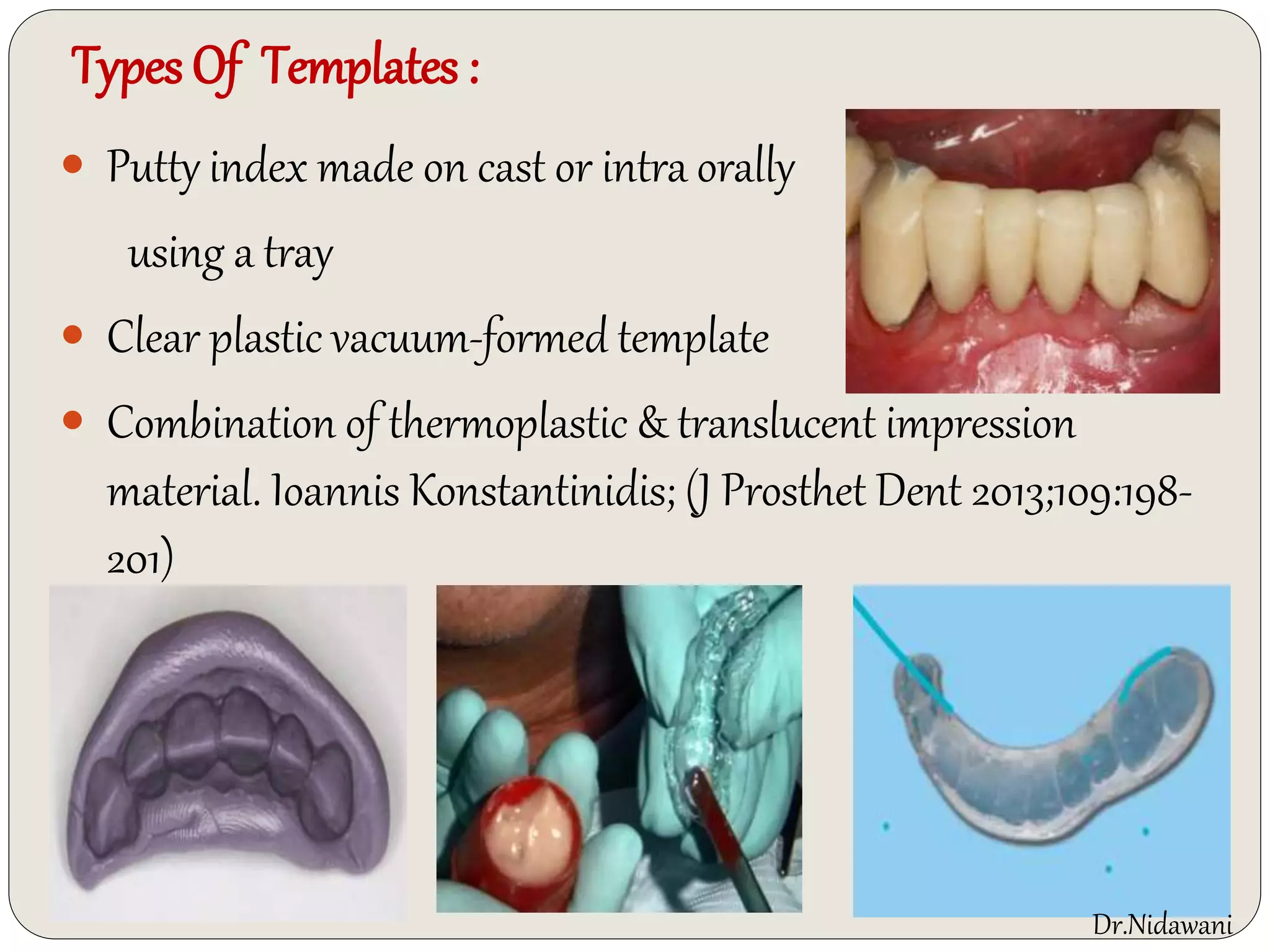 TEMPORIZATION IN PROSTHODONTICS | PPT