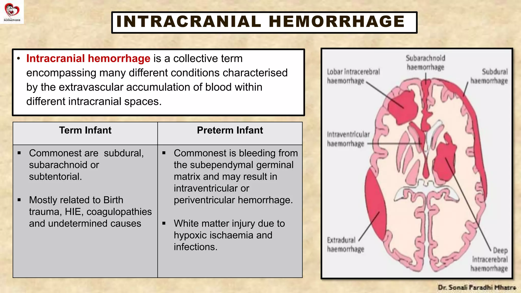 Neonatal Cranial Bleed with Intraventricular hemorrhage | PPTX