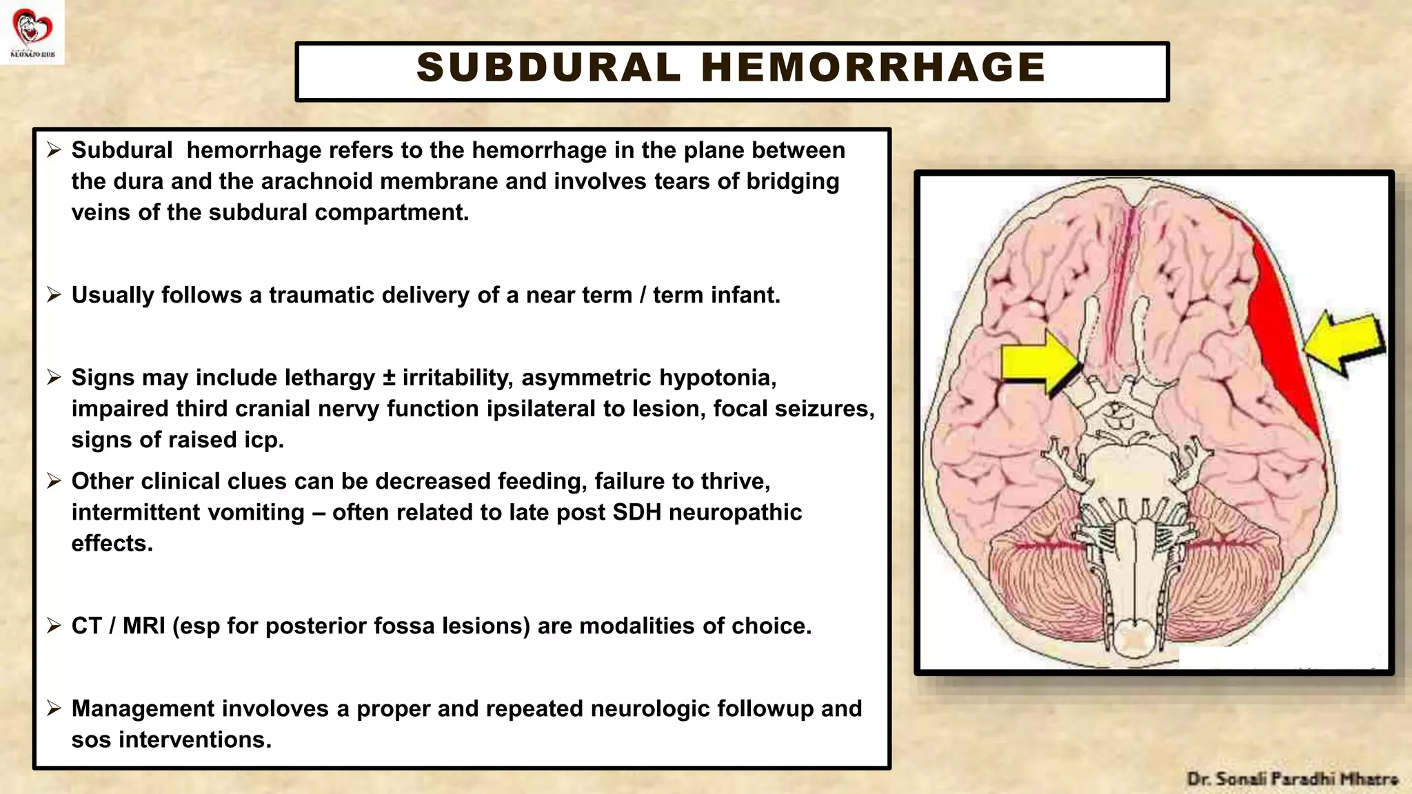 Neonatal Cranial Bleed with Intraventricular hemorrhage | PPTX