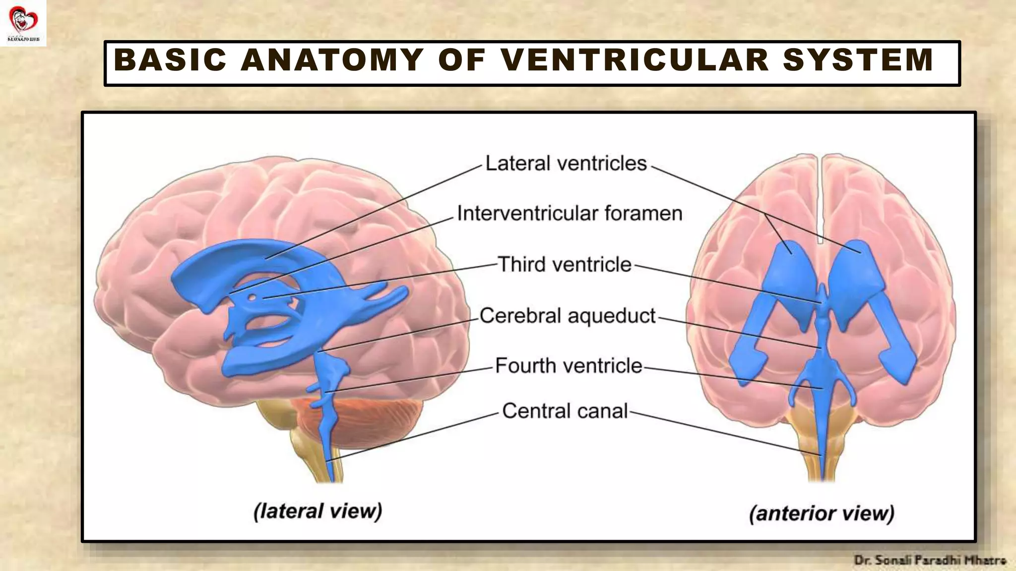 Neonatal Cranial Bleed with Intraventricular hemorrhage | PPTX