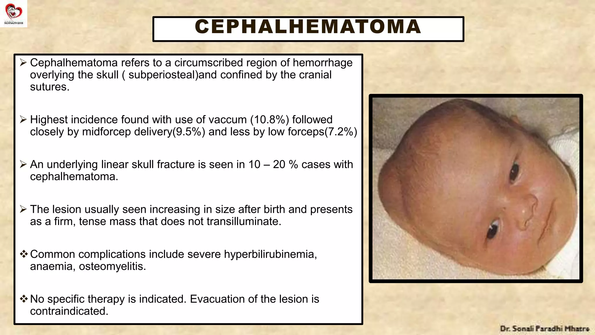 Neonatal Cranial Bleed with Intraventricular hemorrhage | PPTX