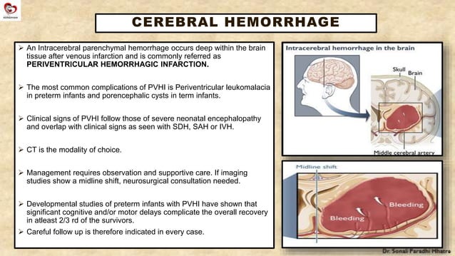 Neonatal Cranial Bleed with Intraventricular hemorrhage | PPTX ...