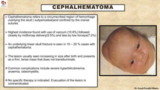 Neonatal Cranial Bleed with Intraventricular hemorrhage | PPTX