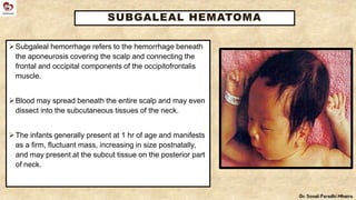 Neonatal Cranial Bleed with Intraventricular hemorrhage | PPTX
