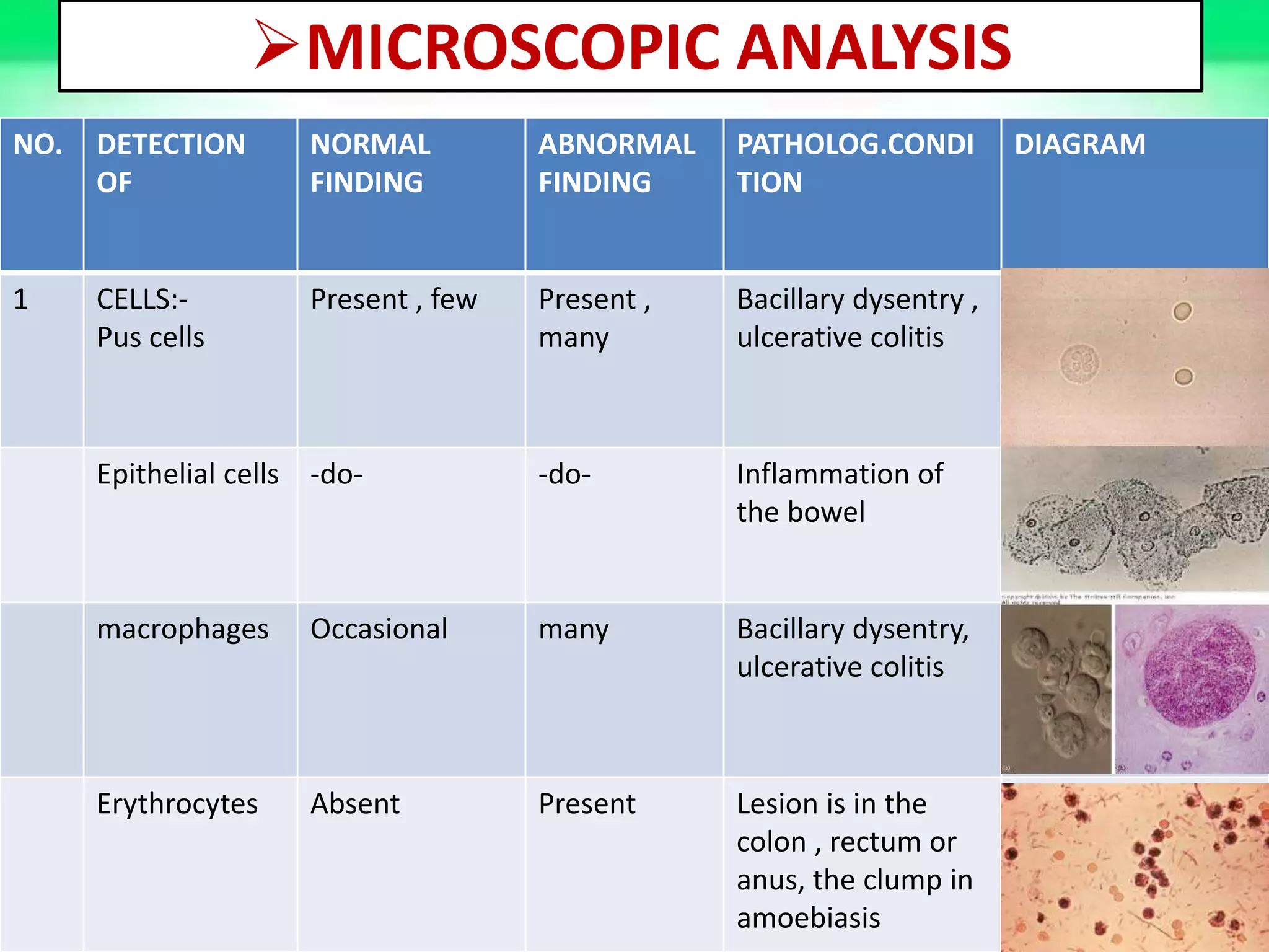 Stool Examination for Routine Practice | PPTX
