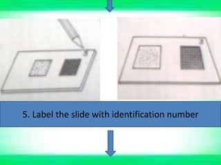 Stool Examination for Routine Practice | PPTX